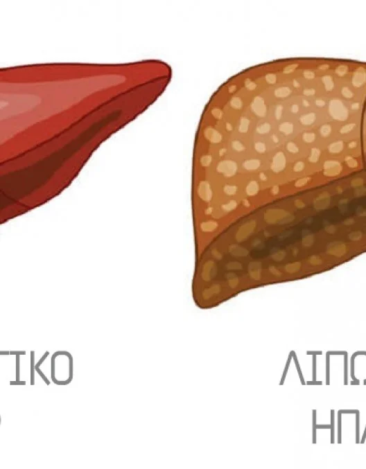 ΛΙΠΟΣ ΣΤΟ ΣΥΚΩΤΙ …..ΥΠΑΡΧΕΙ ΛΥΣΗ